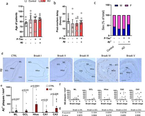 Differential Aβ Accumulation In The Hilus Of Ad Patients A Histogram