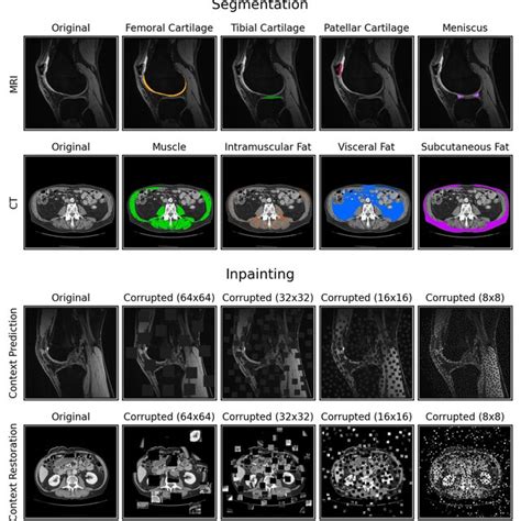 Example Ground Truth Segmentations For The MRI And CT Datasets Both