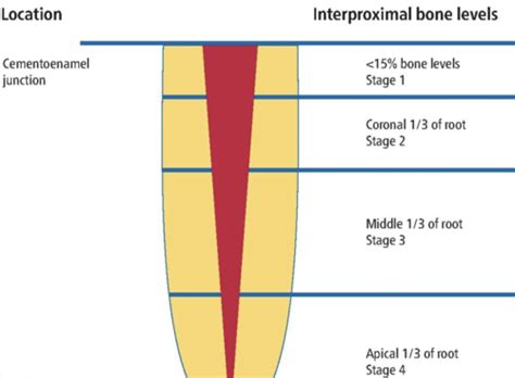 Perio Staging Grading Flashcards Quizlet