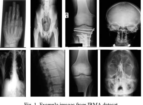Figure 1 From Medical Image Classification With Multiple Kernel Learning Semantic Scholar