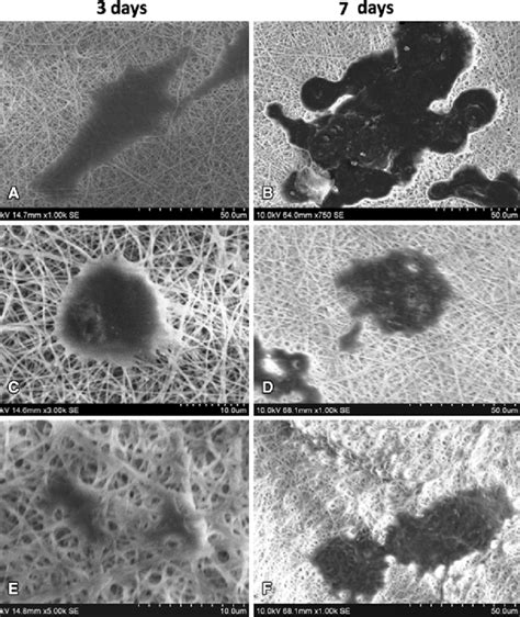 Sem Of Human Dermal Fibroblasts On Electrospun Fibers Of Phbgelatin A