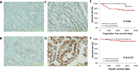 Immunohistochemical Staining Of Ezh2 In A Tissue Microarray Ezh2
