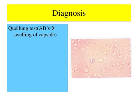 Ppt Hemolytic Streptococci Powerpoint Presentation Free Download