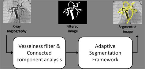 The Flowchart Of Our Proposed Segmentation Framework Download