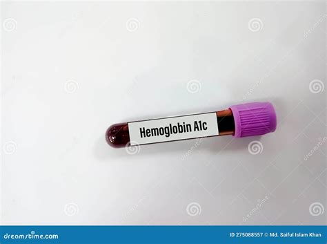 Hemoglobin A1c Hba1c Diabetic Treatment Monitoring Test Stock Image