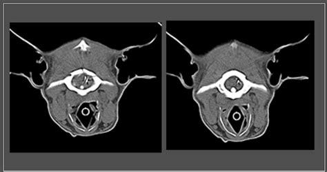 Figure Transverse Slices From Computed Tomography Imaging At The Region