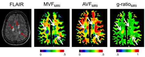 Mapping Tissue Microstructure — Neuropoly Documentation