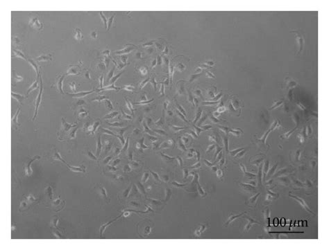 Microphotographs of MDA-MB-231 by optical microscopy. MDA-MB-231 cell ...