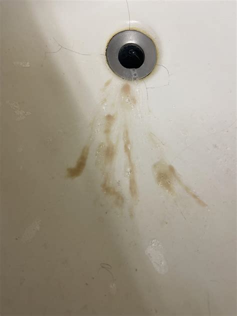 Aftermath Of A Tonsillar Abscess Was Spitting Out Pus For 20 Minutes