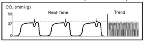 Interpreting Waveform Capnography Pearls And Pitfalls Emdocs