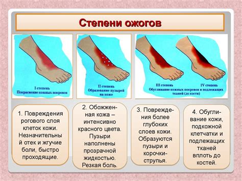 Что делать при ожоге у ребенка кипятком или утюгом — Teletype