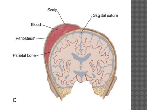 Anatomy Of Scalp Full Detail Pdf