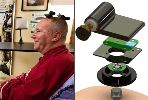 Scientists Create The World S First Wireless Brain Computer Interface With BrainGate Technology