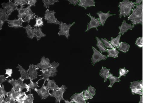 20 Examples Of Effortless Nucleus And Cell Segmentation Using Pretrained Deep Learning Models