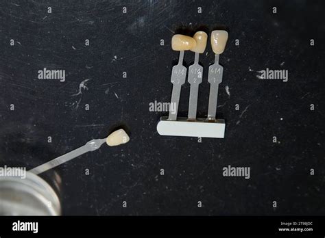 Fabrication Of Dental Crowns And Dentures Made Of Ceramic Scanning Of Plaster Casts Of Teeth