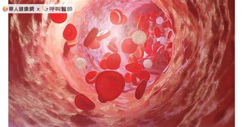 膽固醇過高不能吃蛋？膽固醇反覆超標怎麼辦？陳煒達中醫師揭4大qanda 華人健康網 專業即時優質的健康新聞及資訊分享平台業即時優質的健康