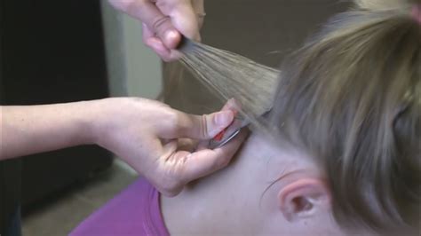 Experts Discuss Effects Of Lice Infestation After Death Of Girl