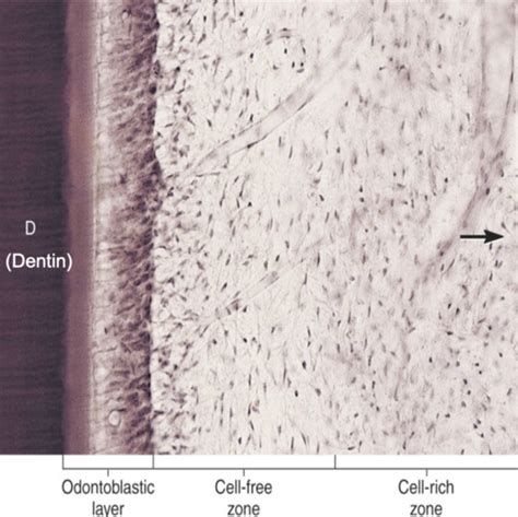 Histology Of Pulp Flashcards Quizlet
