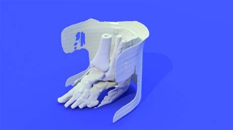 Ancle Testing Stl File Processed Democratiz3d® Processing