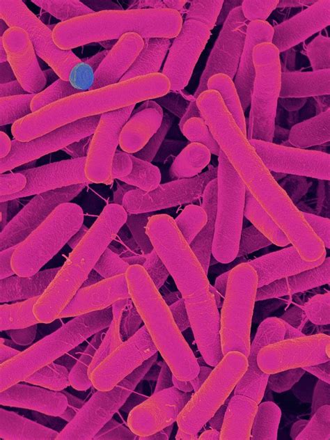 Bacillus Atrophaeus 1 By Science Photo Library