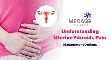 Understanding Uterine Fibroids Pain Management Options Medagg