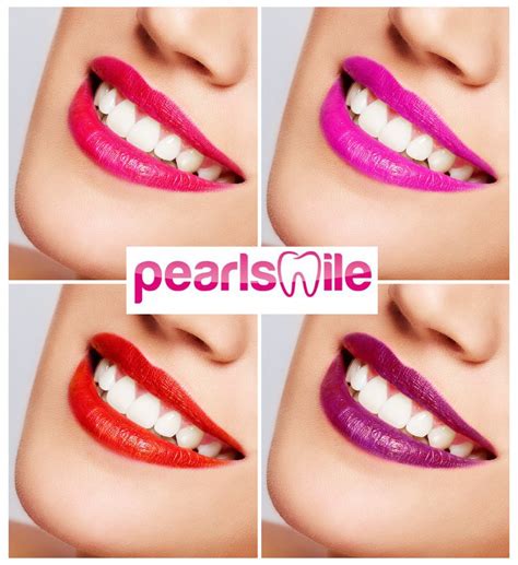 კბილების კოსმეტიკური გათეთრება