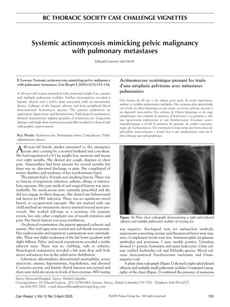 Pdf Systemic Actinomycosis Mimicking Pelvic Malignancy With Pulmonary
