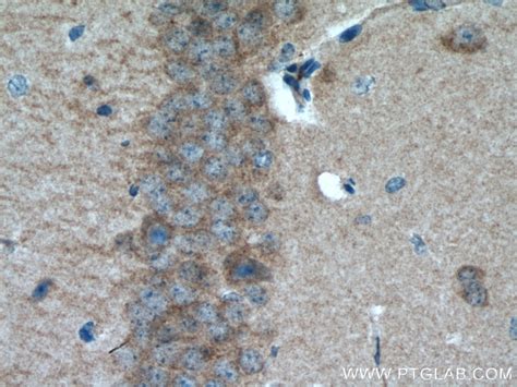 GABARAPL Antibody AP Proteintech