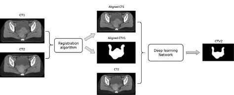 Figure 3 From A Prior‐information‐based Automatic Segmentation Method