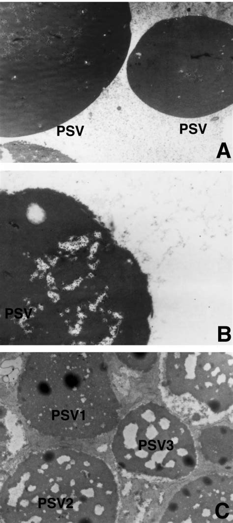 Electron Micrographs Showing The Localization Of Mcp In Protein Storage Download Scientific
