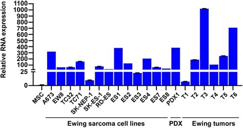 Slit2 Rna Expression In Ewing Sarcoma Cell Lines And Tumors The Slit2