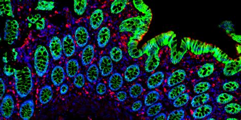 Tissue Preparations And Handling For Multiplex Imaging In Spatial