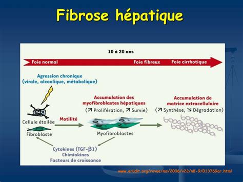 PPT Evaluation non invasive de la fibrose hépatique PowerPoint