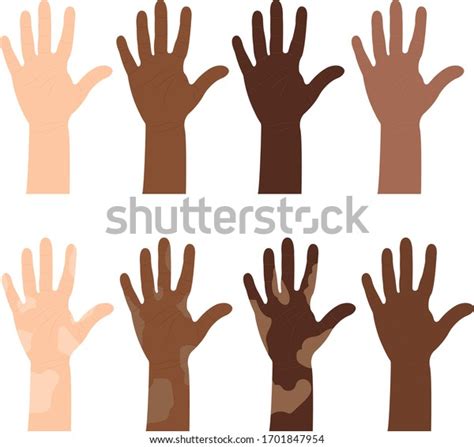 Hands Different Skin Color Options Stock Vector Royalty Free 1701847954 Shutterstock