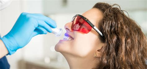Diy Vs Professional Teeth Whitening Whats Worth It Newmarket