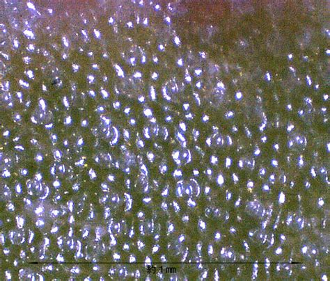 マツバギクの気孔 実体顕微鏡写真集 気ままに自然観察