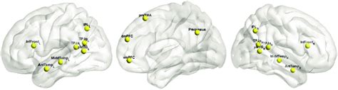 The Localization Of A Priori Rois L Left R Right Inferior