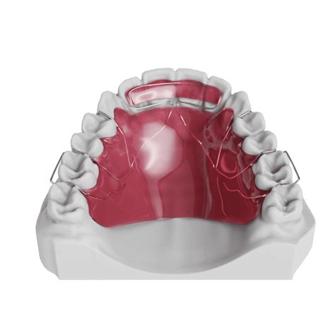 Spring Aligner Odl Orthodontic Labs