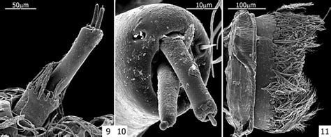 Hedyselmis Opis Larva 9 Antenna Dorsal View 10 Antennal Flagellum