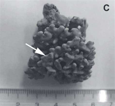 Lithophyllum Flashcards Quizlet