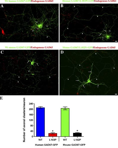 Mutation Of Leucine 103 In Human Gad67 And Leucine 102 In Mouse Gad67 Download Scientific