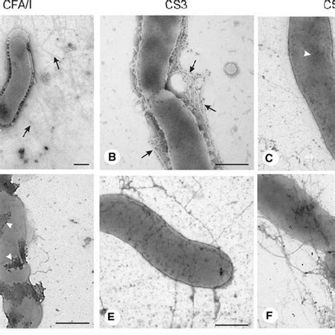 Expression Of CFA I CS And CS Antigens In Monovalent Recombinant