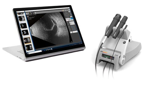 Scanmate Flex Three Probe Options One Powerful Platform