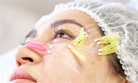 What You Should Know About Mono Threads