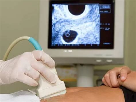 孕囊尺寸的3个数据图解在这里，使用正确公式准确性超高 柚喜问答