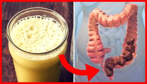 Remédios caseiros para limpar o cólon como usar dicas e receitas