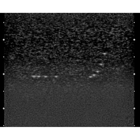 US Breast Ultrasound QA Phantom MediScientific