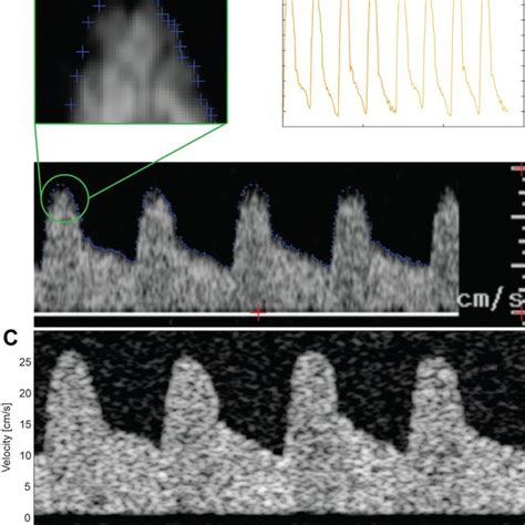 Depiction Of How Doppler Spectra Were Traced And Regenerated A The Download Scientific