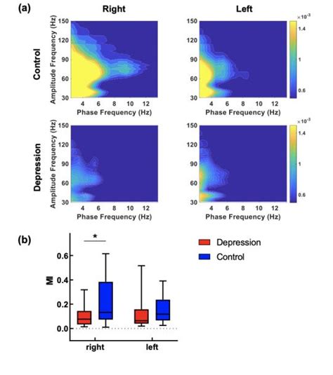 Figure 5 From Gamma Rhythm And Theta Gamma Coupling Alternation In Chronic Unpredictable Stress