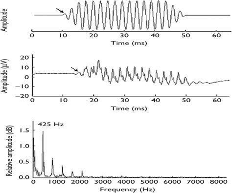 Auditory Frequency Following Responses In Rat Ipsilateral In Neuroreport
